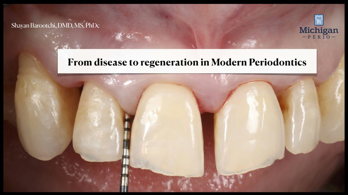 From disease to regeneration: Saving teeth with modern Periodontics at ...