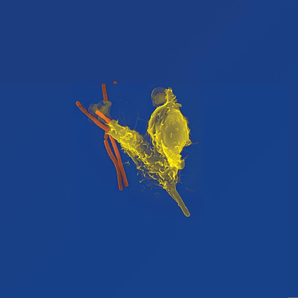 Gentle handling and imaging for granulocytes at Duke-NUS Medical School ...