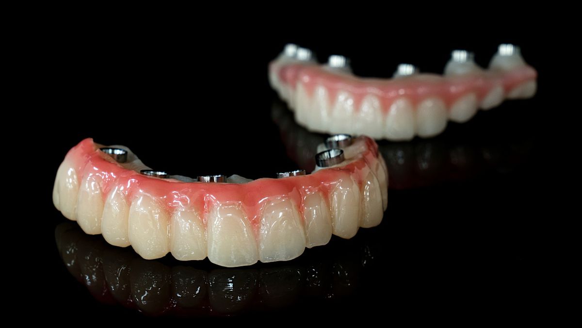 Digitally Guided Full Arch Fixed Restoration I Portland, OR at ...