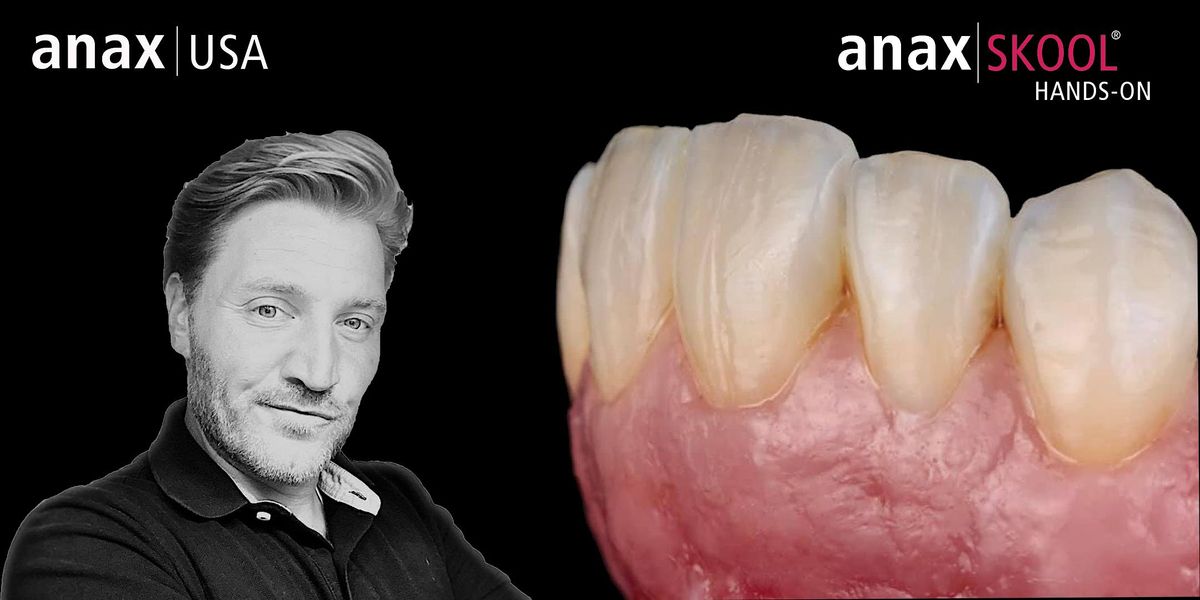 Gingival Form, Texture & Replication in anaxgum w/ Florian Steinheber ...