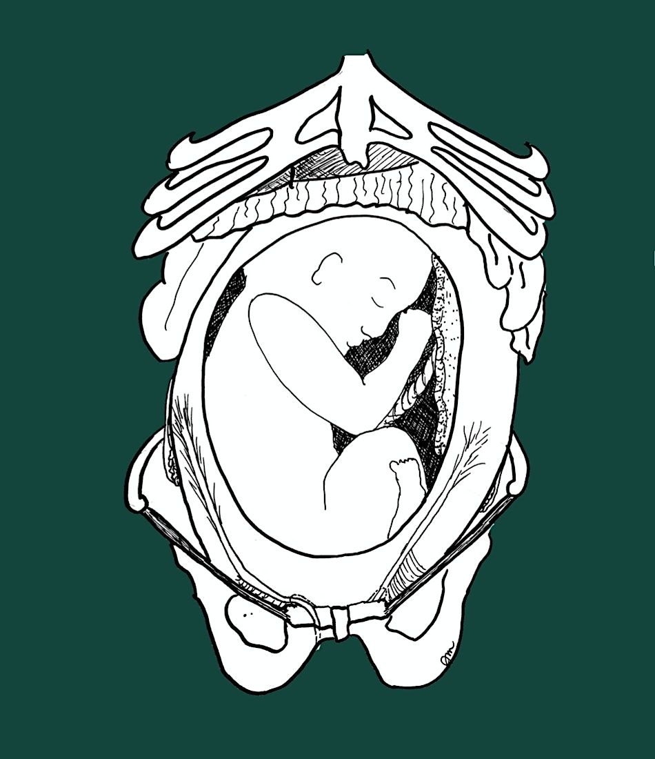 The Breech Release Workshop - Opening Pathways for Midwifery and ...