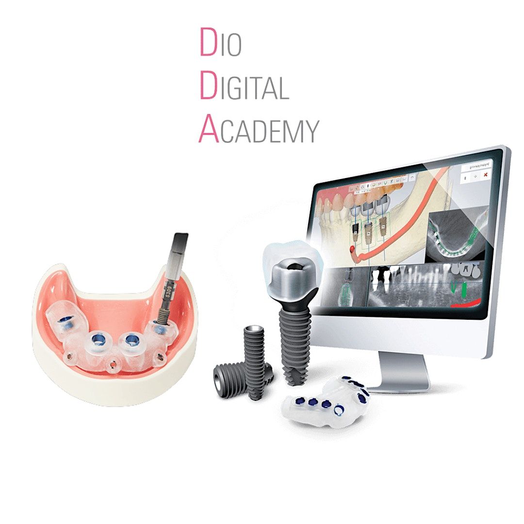 Perfect Placement Digitally Guided Dental Implant System | Baltimore ...