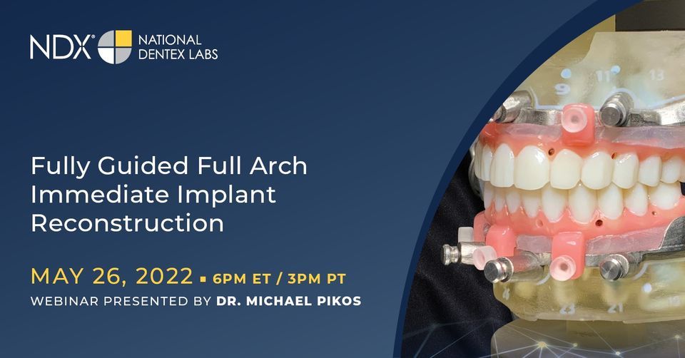 Fully Guided Full Arch Immediate Implant Reconstruction at online on ...